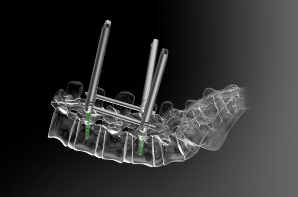 Home | Biedermann Motech GmbH & Co. KG