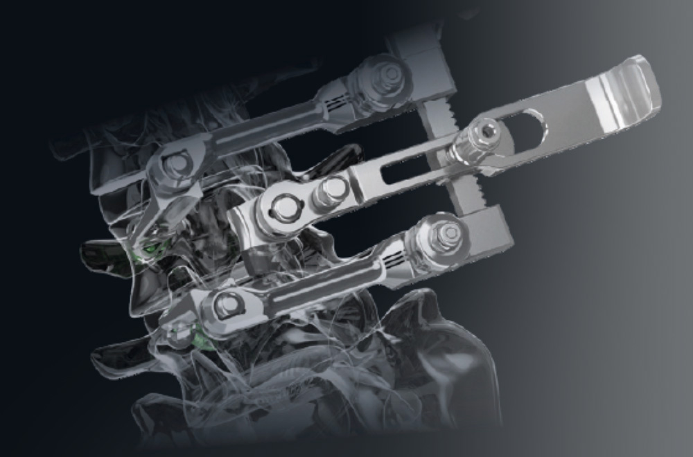 Home | Biedermann Motech GmbH & Co. KG