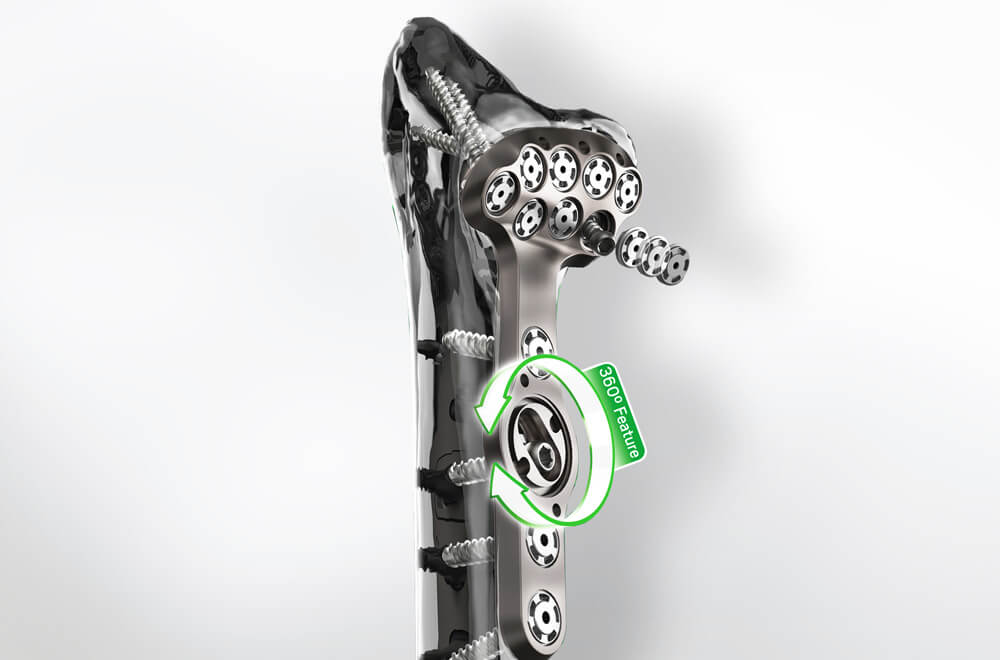 Home | Biedermann Motech GmbH & Co. KG