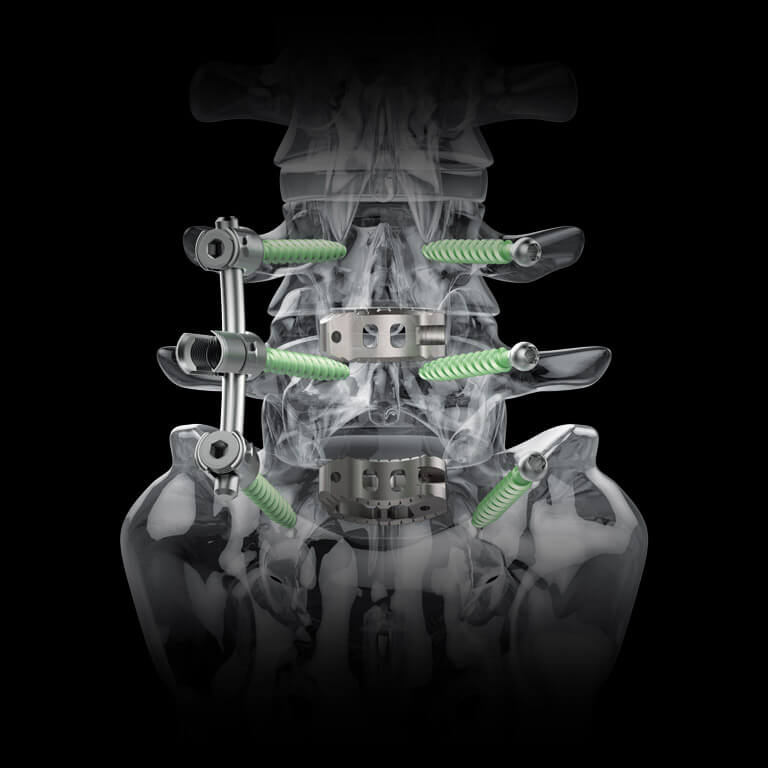 Spine | Biedermann Motech GmbH & Co. KG
