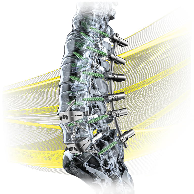 Spine | Biedermann Motech GmbH & Co. KG