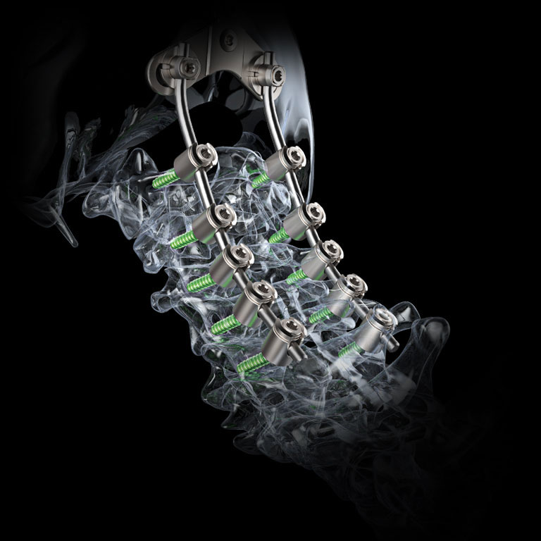 Spine | Biedermann Motech GmbH & Co. KG