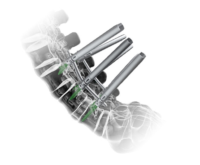Spine | Biedermann Motech GmbH & Co. KG